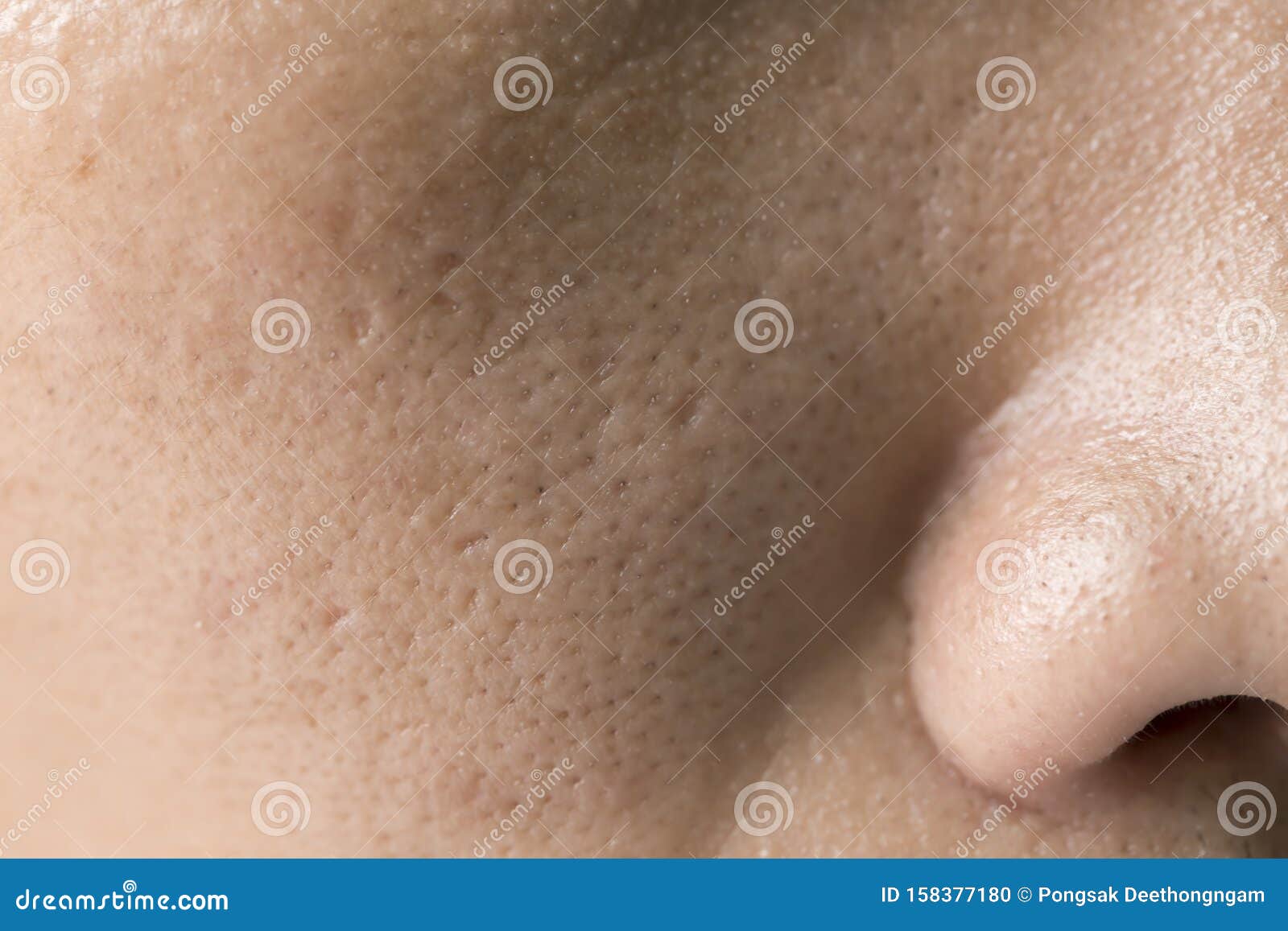 Asian Face, Skin Problems stock photo. Image of portrait - 158377180