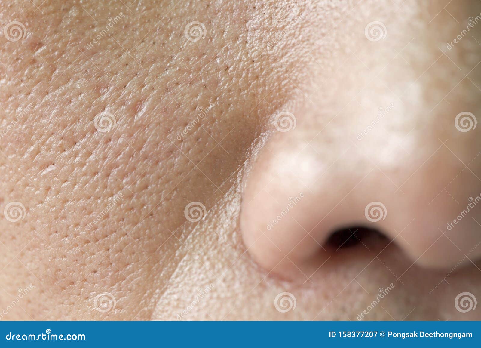 Asian Face, Skin Problems stock image. Image of face - 158377207