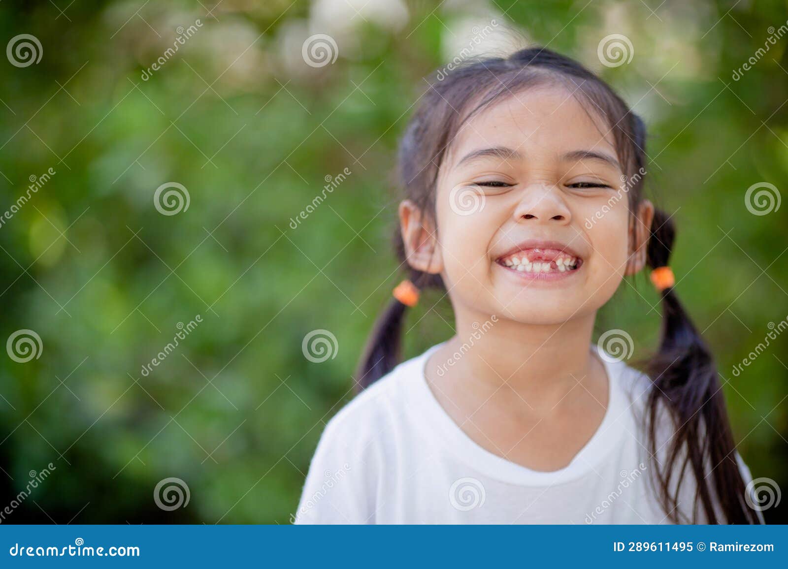 Asian Little Girl Displays a Missing Tooth Stock Image - Image of proud ...