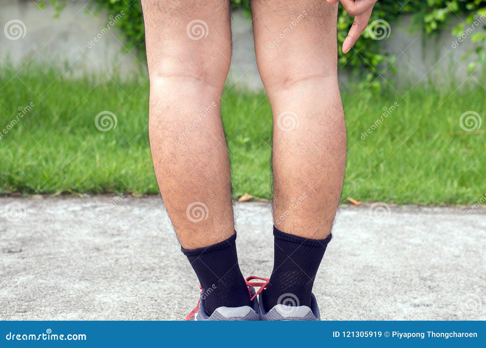 Asian Man Leg Bandy-legged Shape Of Legs Stock Image | CartoonDealer ...