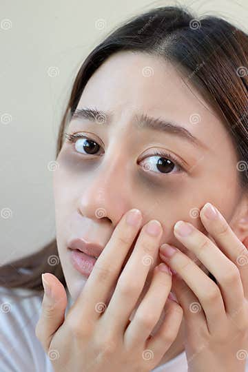 Asian Young Female Stress Looking Mirror Have Dark Eye Circles From