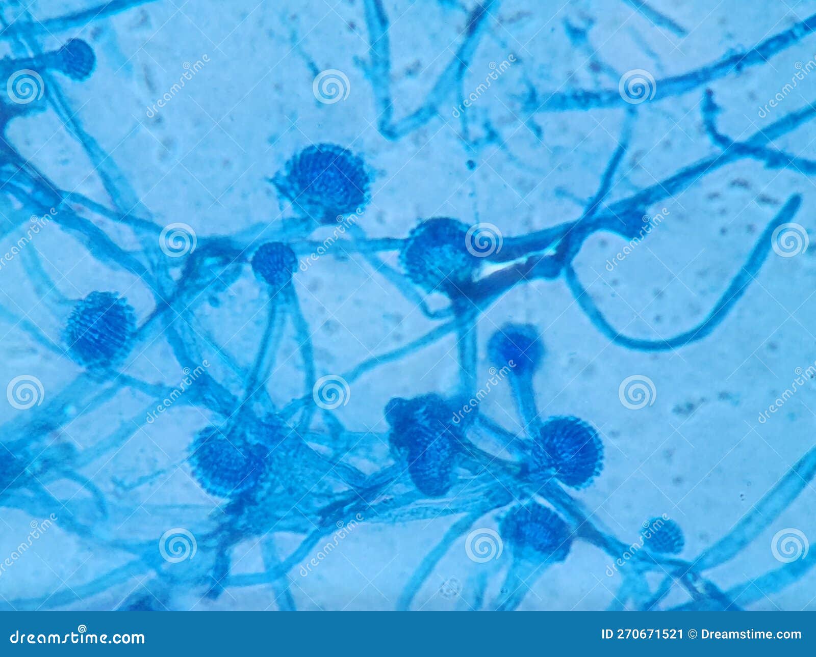 Aspergillus Conidiophores Stained with Lactophenol Cotton Blue Stock ...