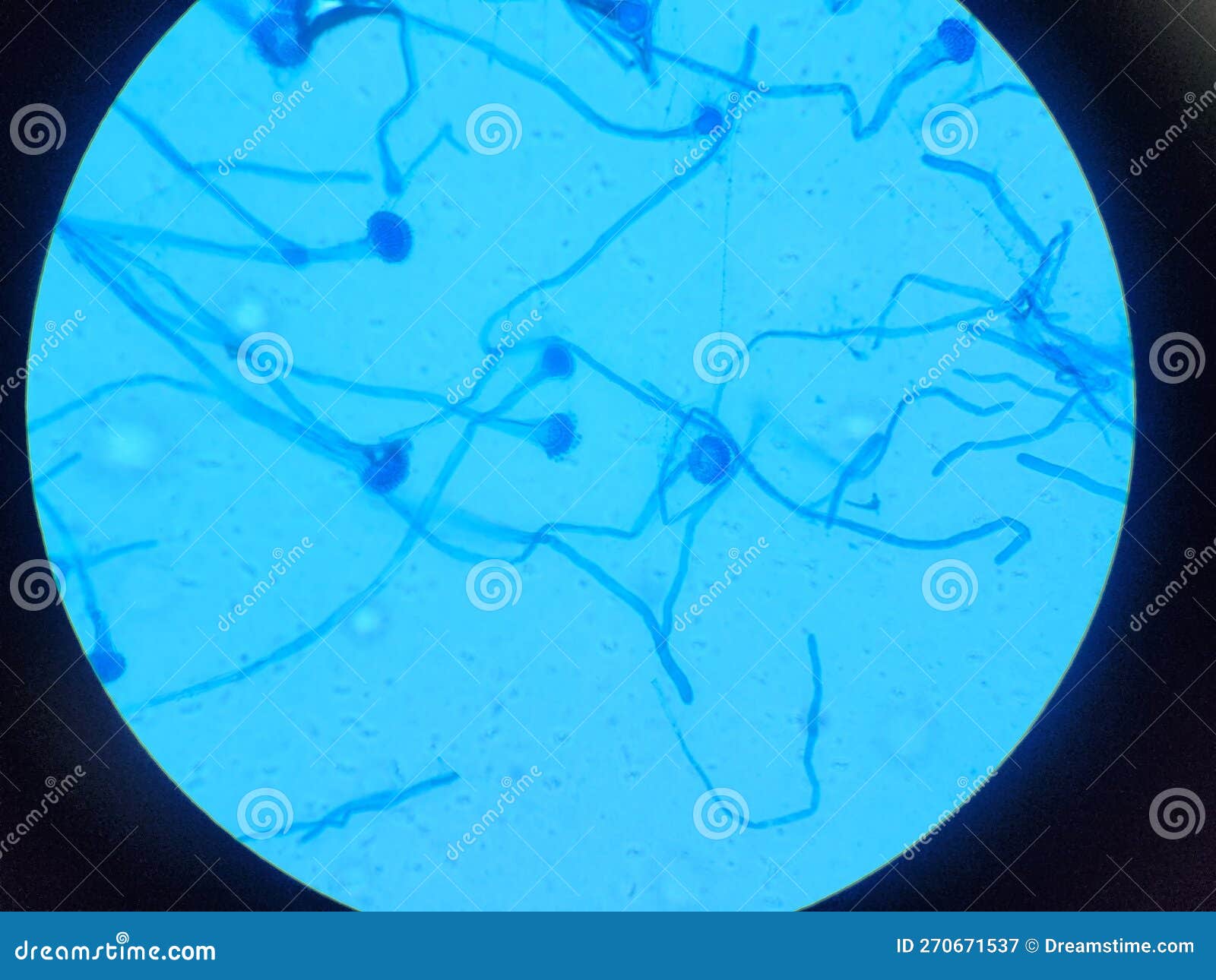 Aspergillus Conidiophores Stained with Lactophenol Cotton Blue Stock ...