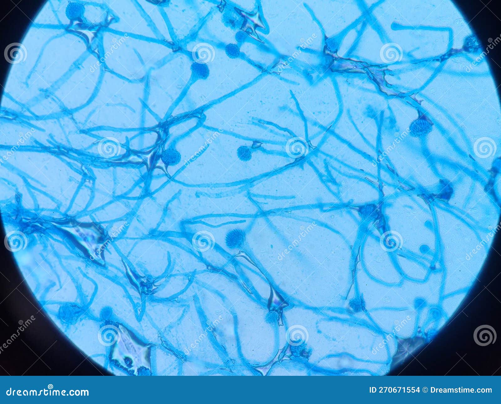 Aspergillus Conidiophores Stained with Lactophenol Cotton Blue Stock ...