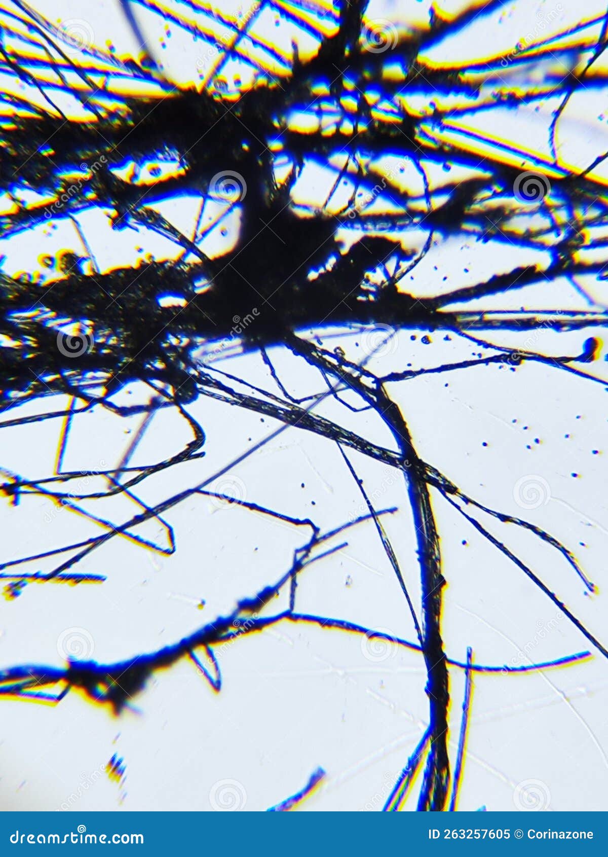 Aspergillus Genus Mold Under the Microscope Stock Image - Image of ...