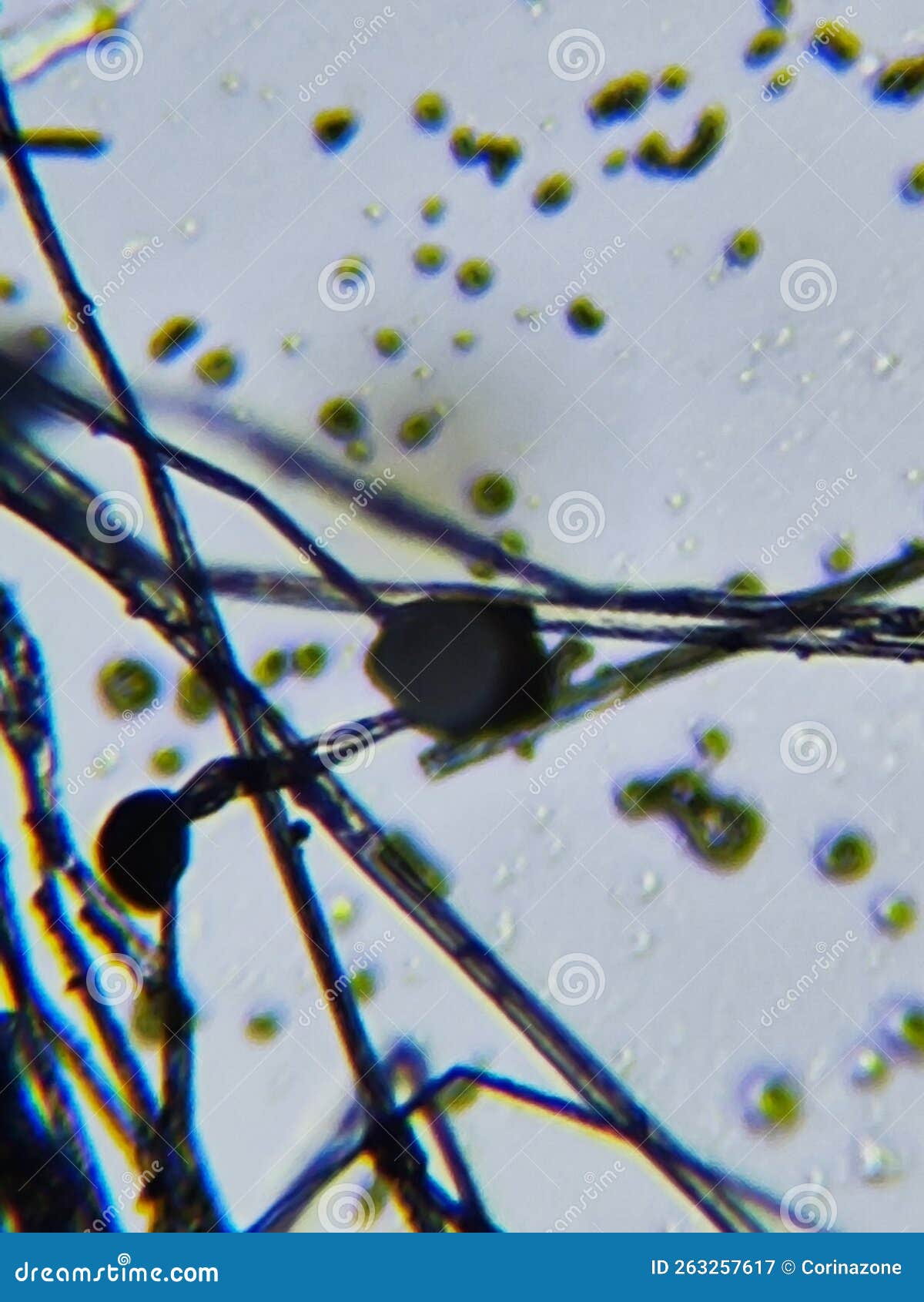 Aspergillus Genus Mold Under the Microscope Stock Image - Image of ...