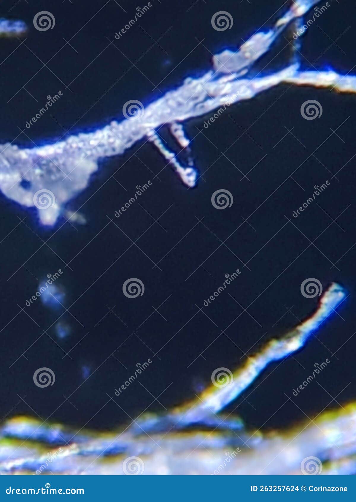 Aspergillus Genus Mold Under the Microscope Stock Photo - Image of ...