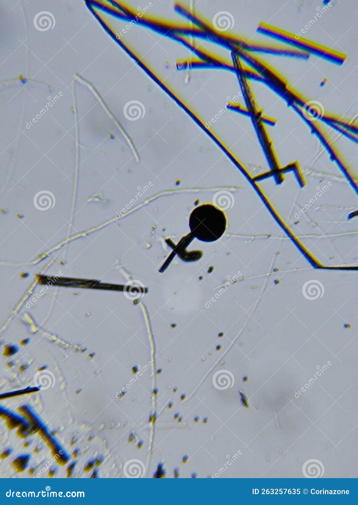 Aspergillus Genus Mold Under the Microscope Stock Image - Image of ...