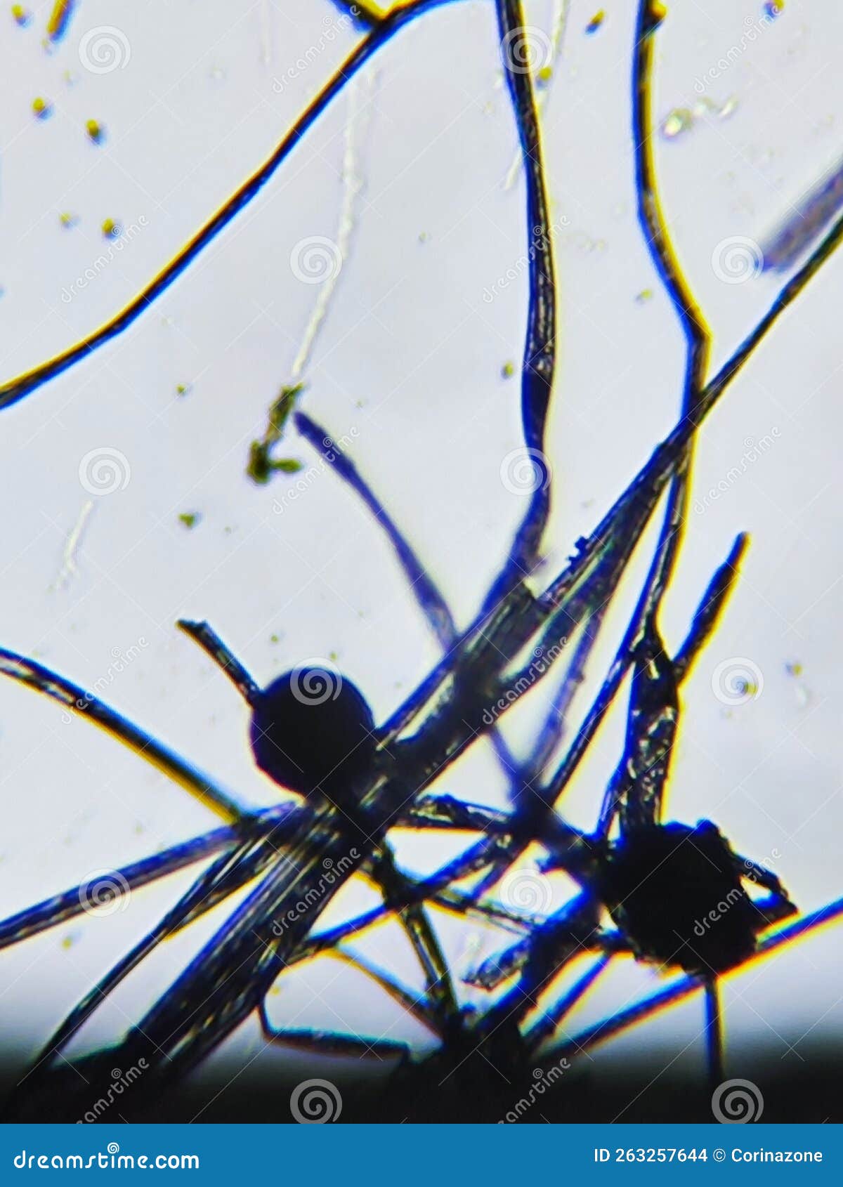 Aspergillus Genus Mold Under the Microscope Stock Photo - Image of ...