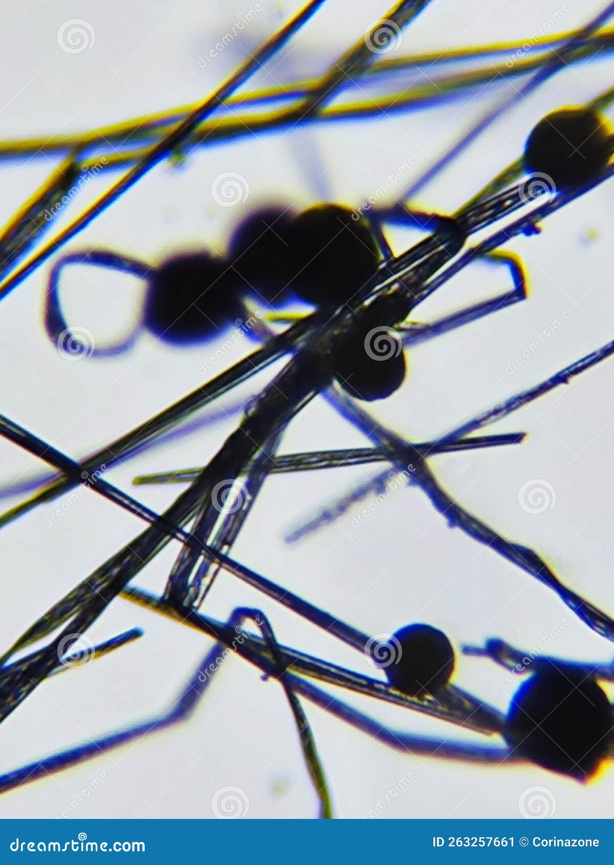 Aspergillus Genus Mold Under the Microscope Stock Image - Image of ...