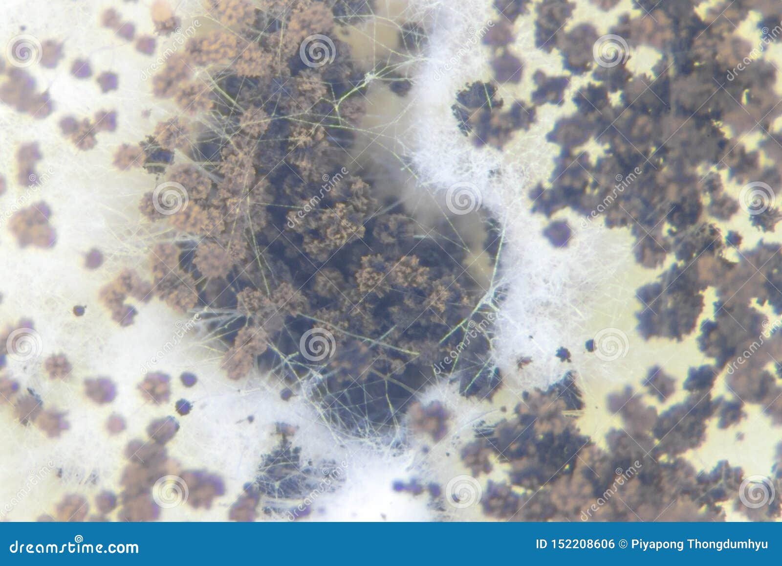 Aspergillus Mold Under The Light Microscopic View Royalty-Free Stock ...