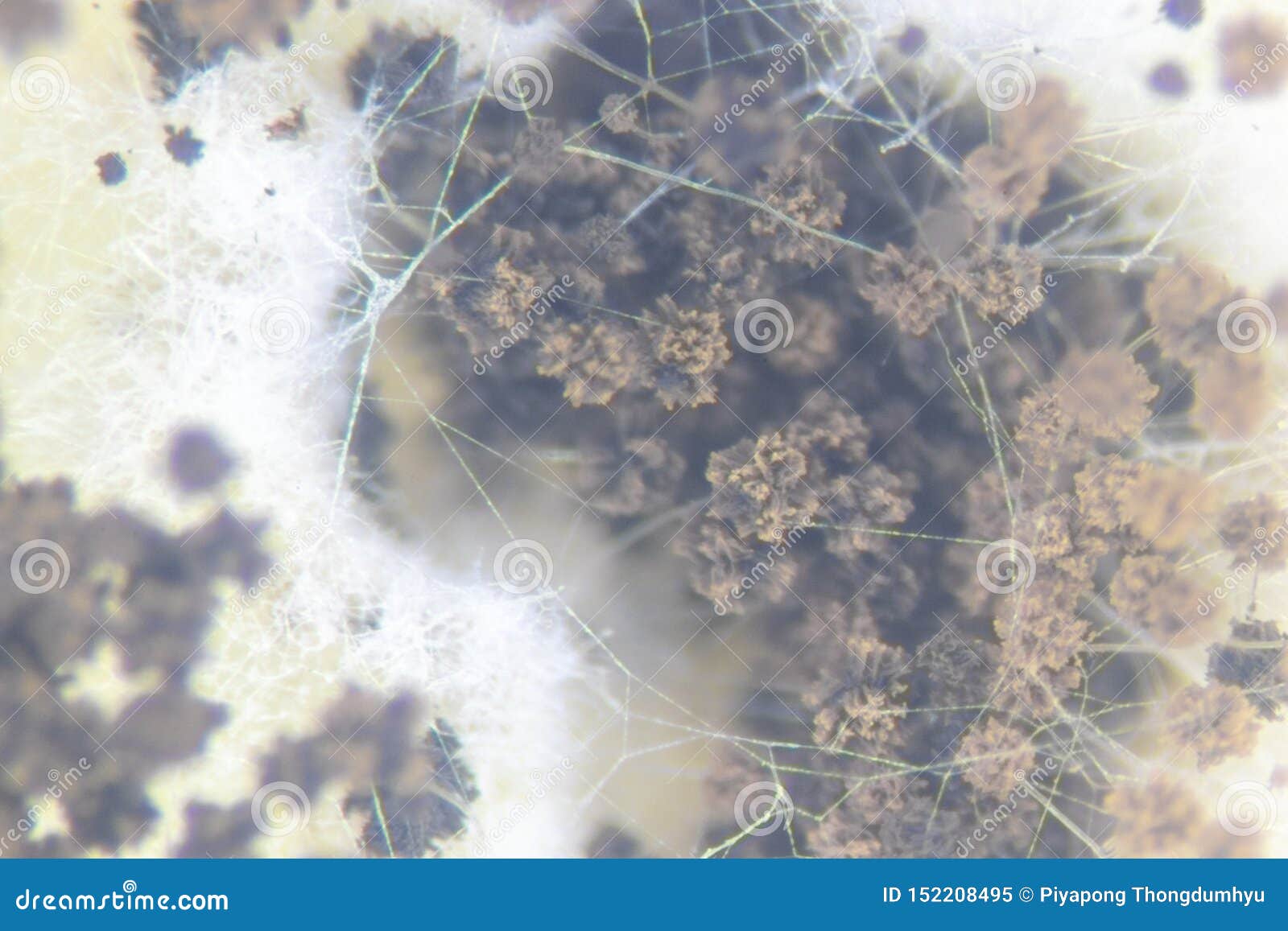Aspergillus Mold Under The Light Microscopic View Royalty-Free Stock ...
