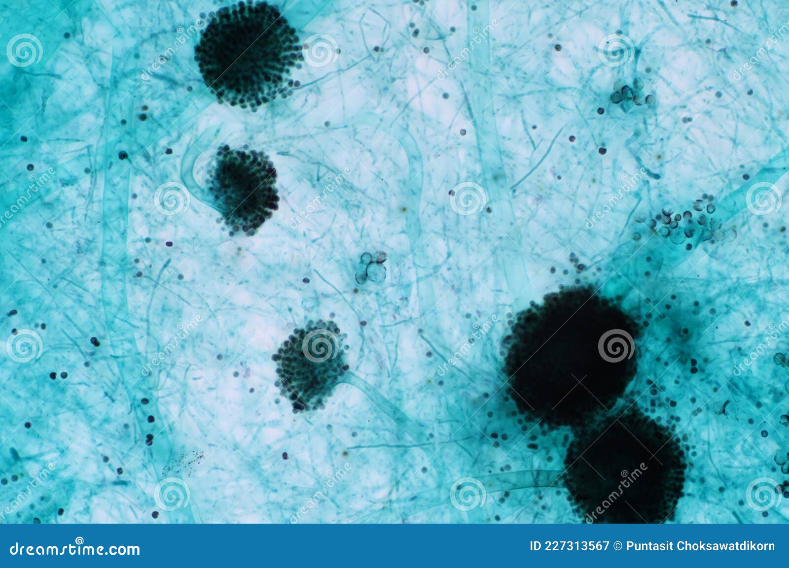Aspergillus Mold Under the Light Microscopic View Stock Image - Image ...