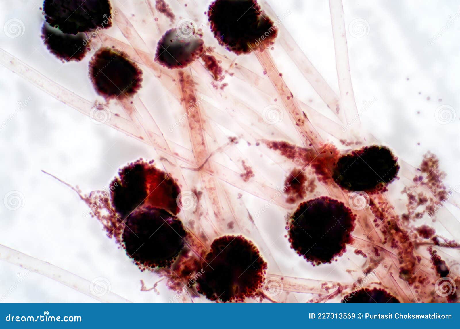 Aspergillus Mold Under The Light Microscopic View Royalty-Free Stock ...