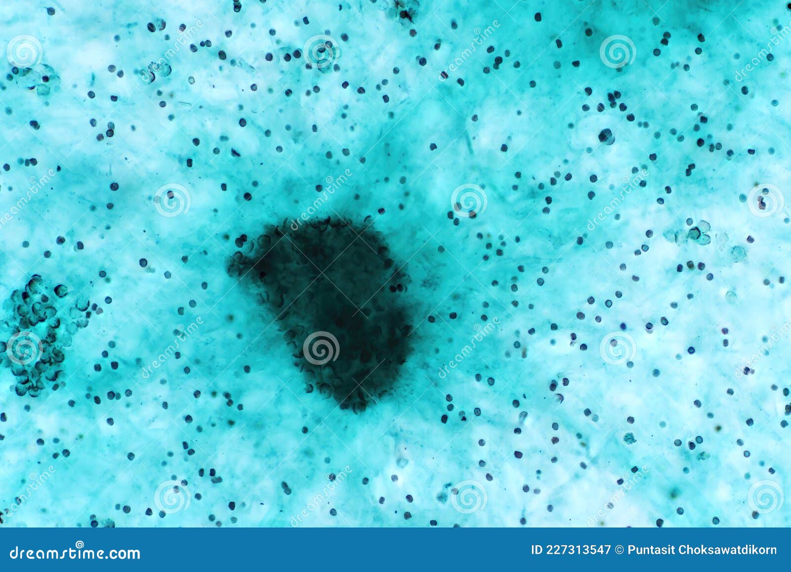 Aspergillus Mold Under The Light Microscopic View Royalty-Free Stock ...