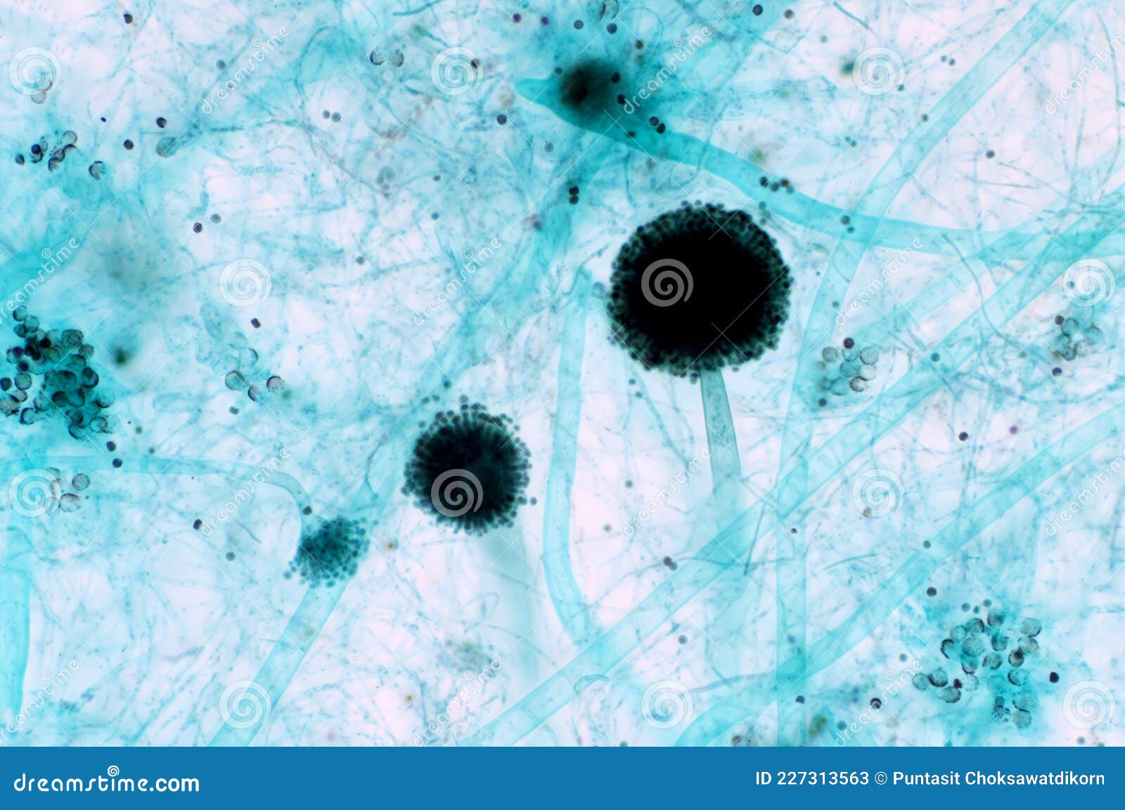 Aspergillus Mold Under The Light Microscopic View Royalty-Free Stock ...