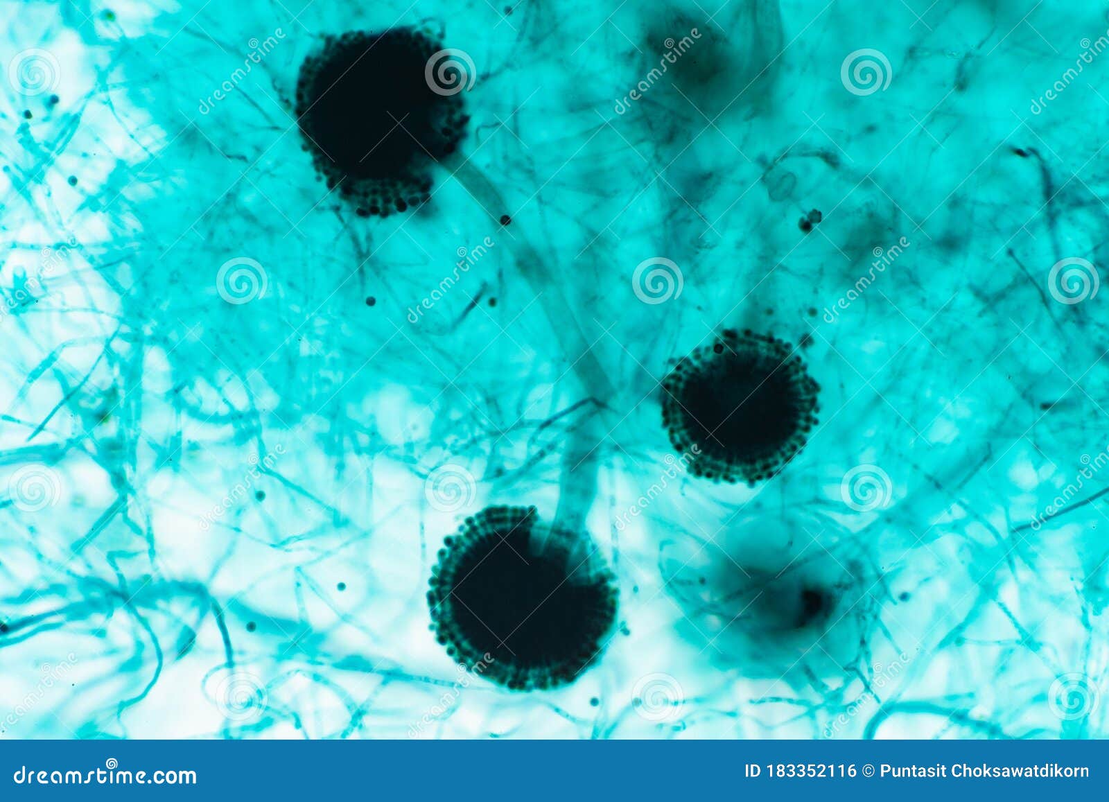 Aspergillus Mold Under Microscopic View for Education Stock Photo ...