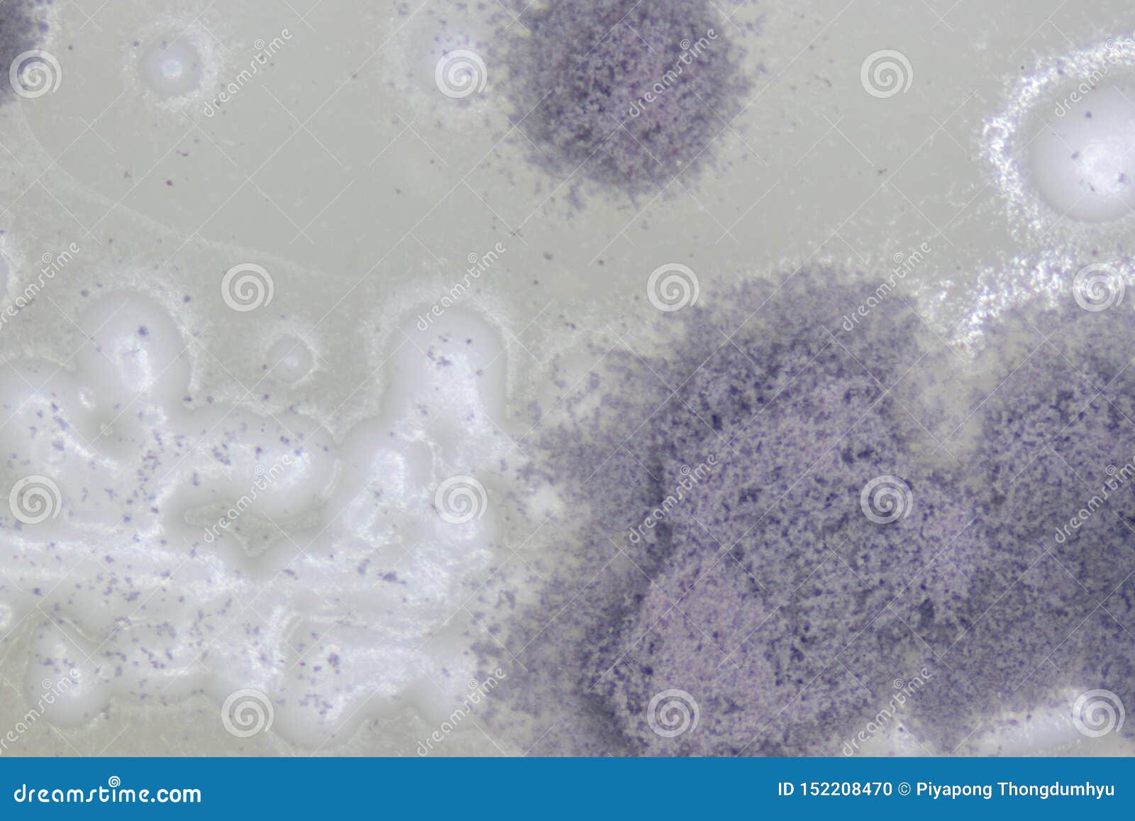 Aspergillus Mold Under The Light Microscopic View Royalty-Free Stock ...