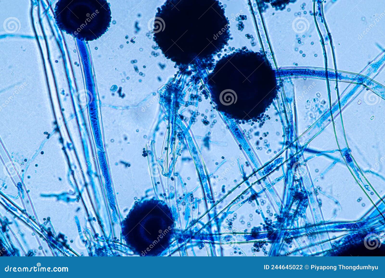 Aspergillus Niger and Aspergillus Oryzae Mold Under Microscope. Stock ...