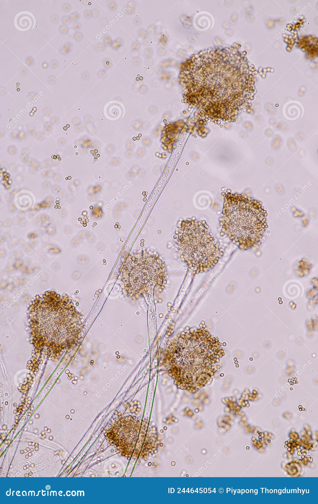 Aspergillus Niger Under Microscope