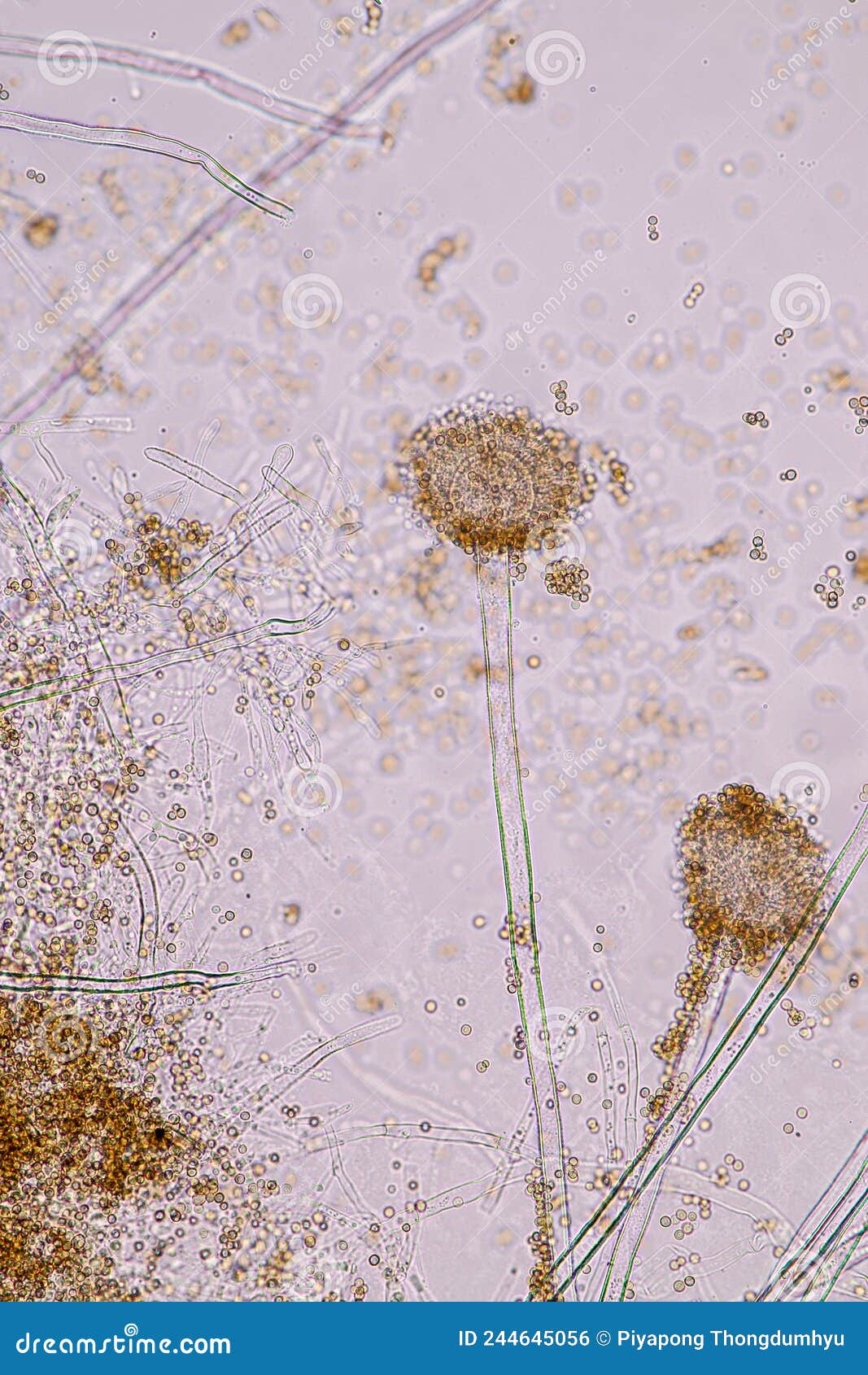 Aspergillus Niger Under Microscope