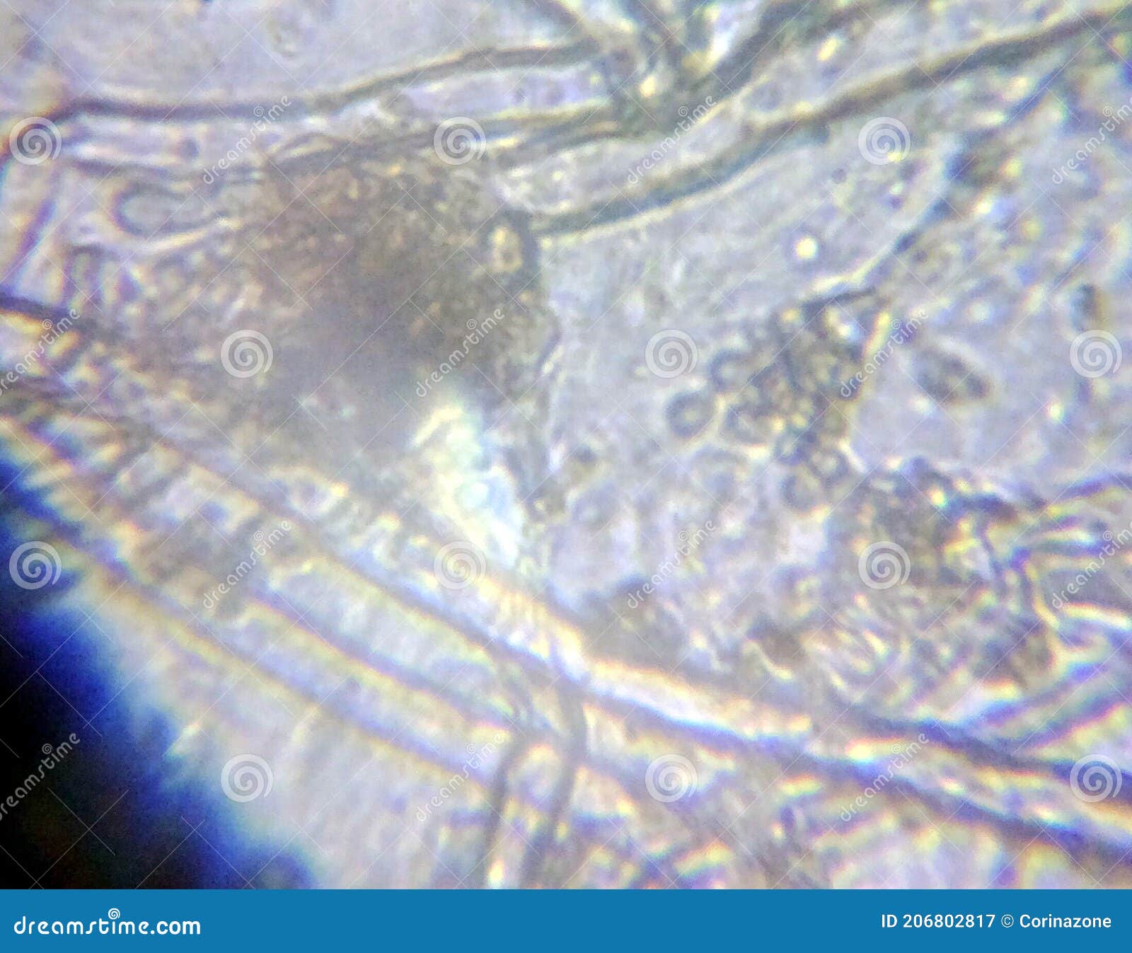 Aspergillus Niger the Black Mold Conidia Under the Microscope Stock ...