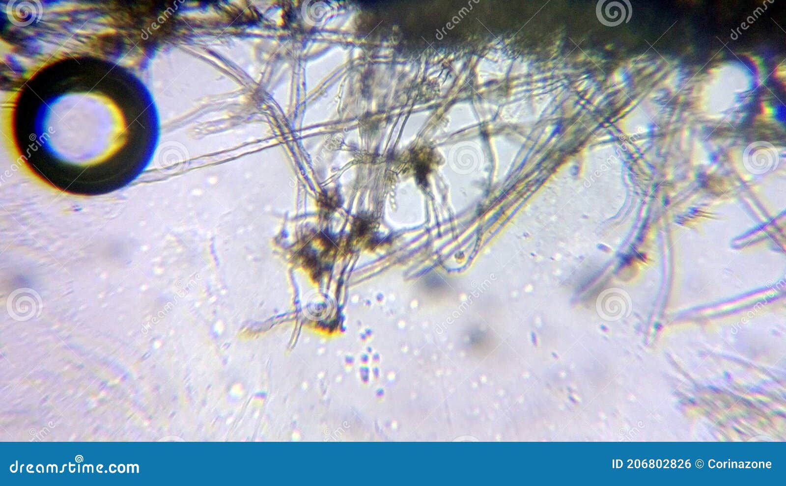 Aspergillus Niger the Black Mold Conidia Under the Microscope Stock ...