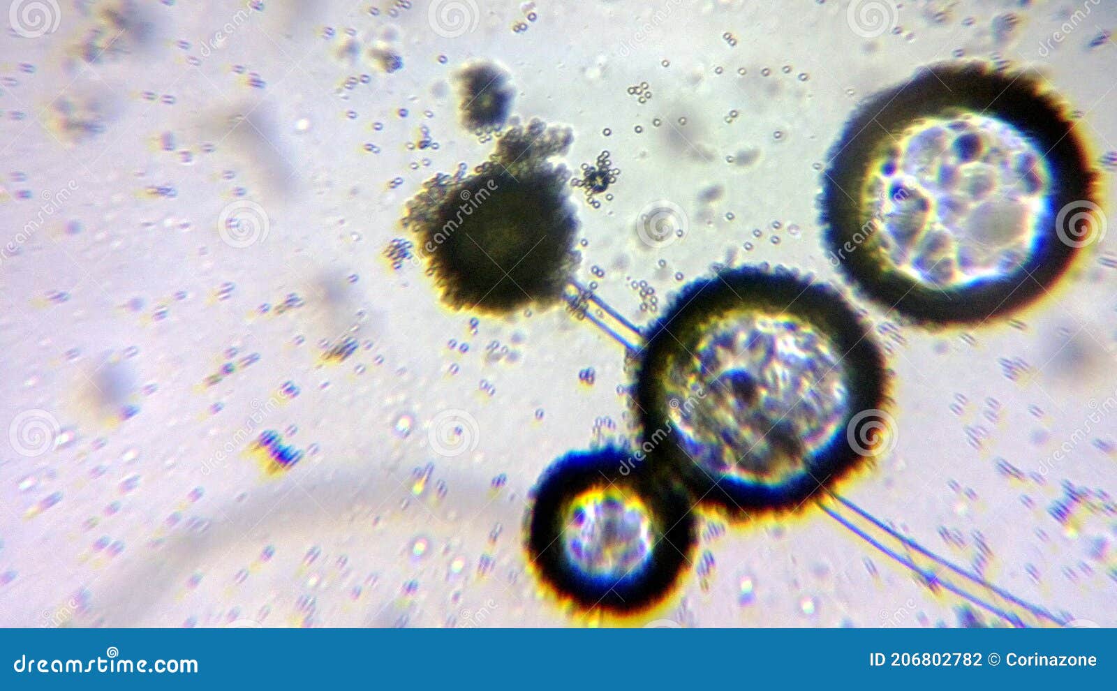 Aspergillus Niger the Black Mold Conidia Under the Microscope Stock ...