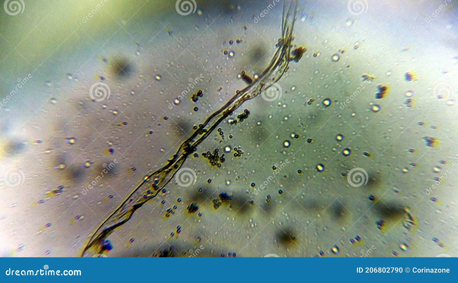 Aspergillus Niger the Black Mold Conidia Under the Microscope Stock ...
