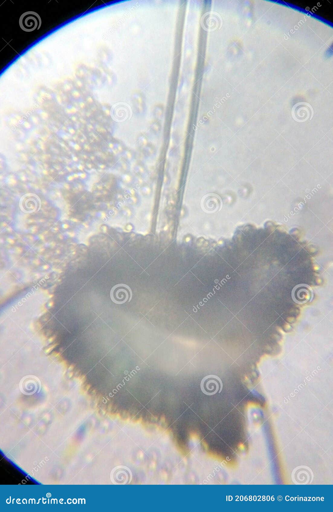 Aspergillus Niger the Black Mold Conidia Under the Microscope Stock ...