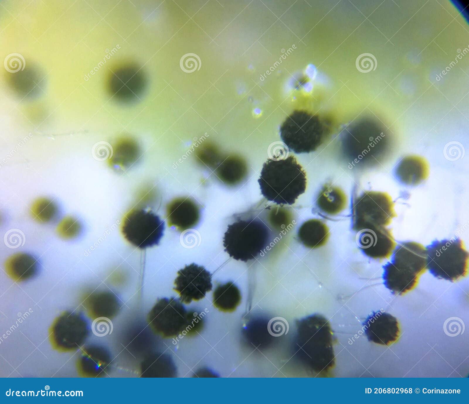 Aspergillus Niger the Black Mold Conidia Under the Microscope Stock ...
