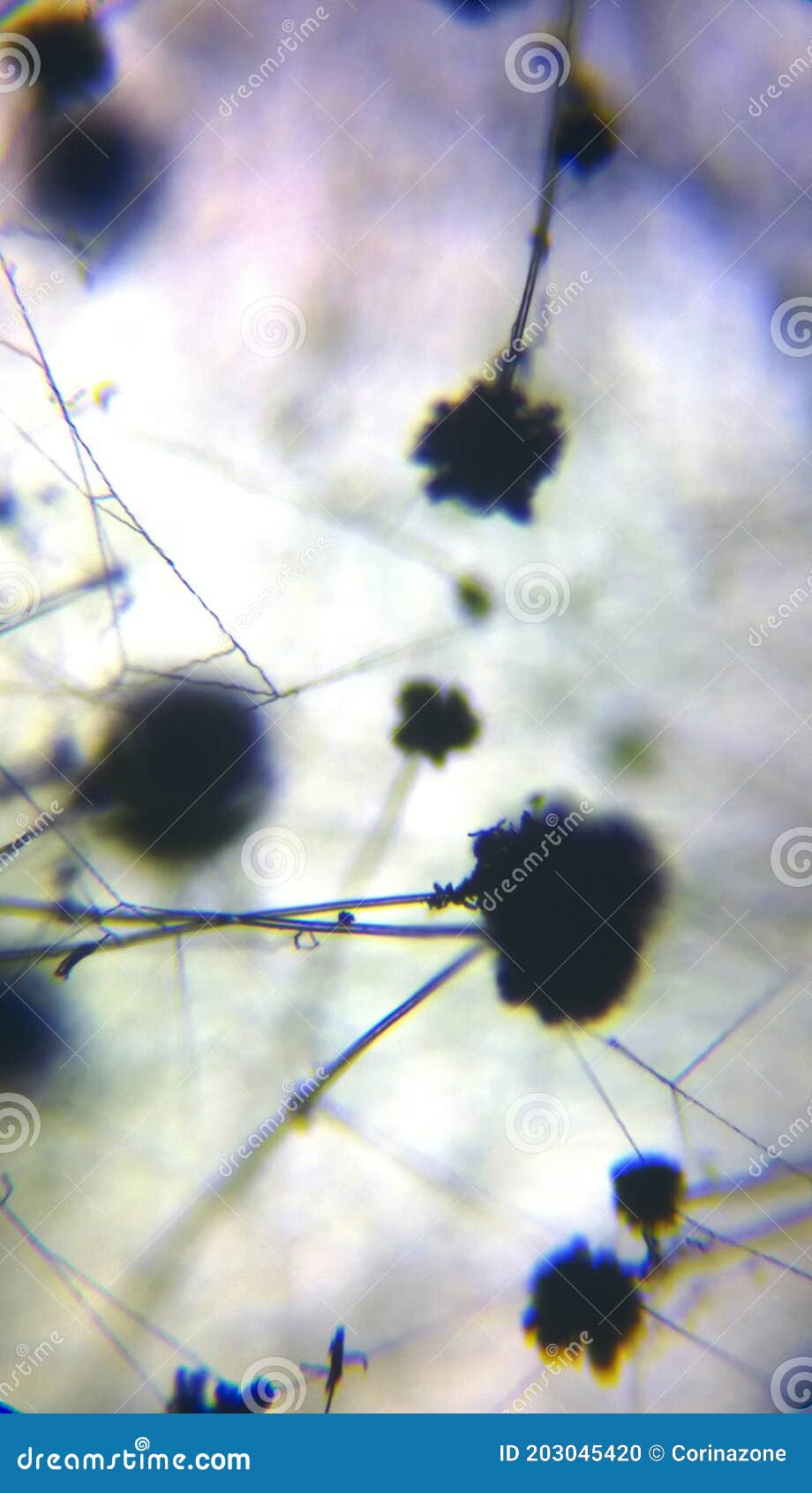 Aspergillus Niger Conidia Under the Microscope Stock Photo - Image of ...