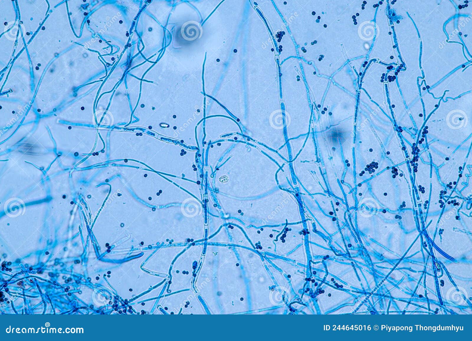 Aspergillus Niger E Aspergillus Oryzae Muffe Sotto Microscopio ...