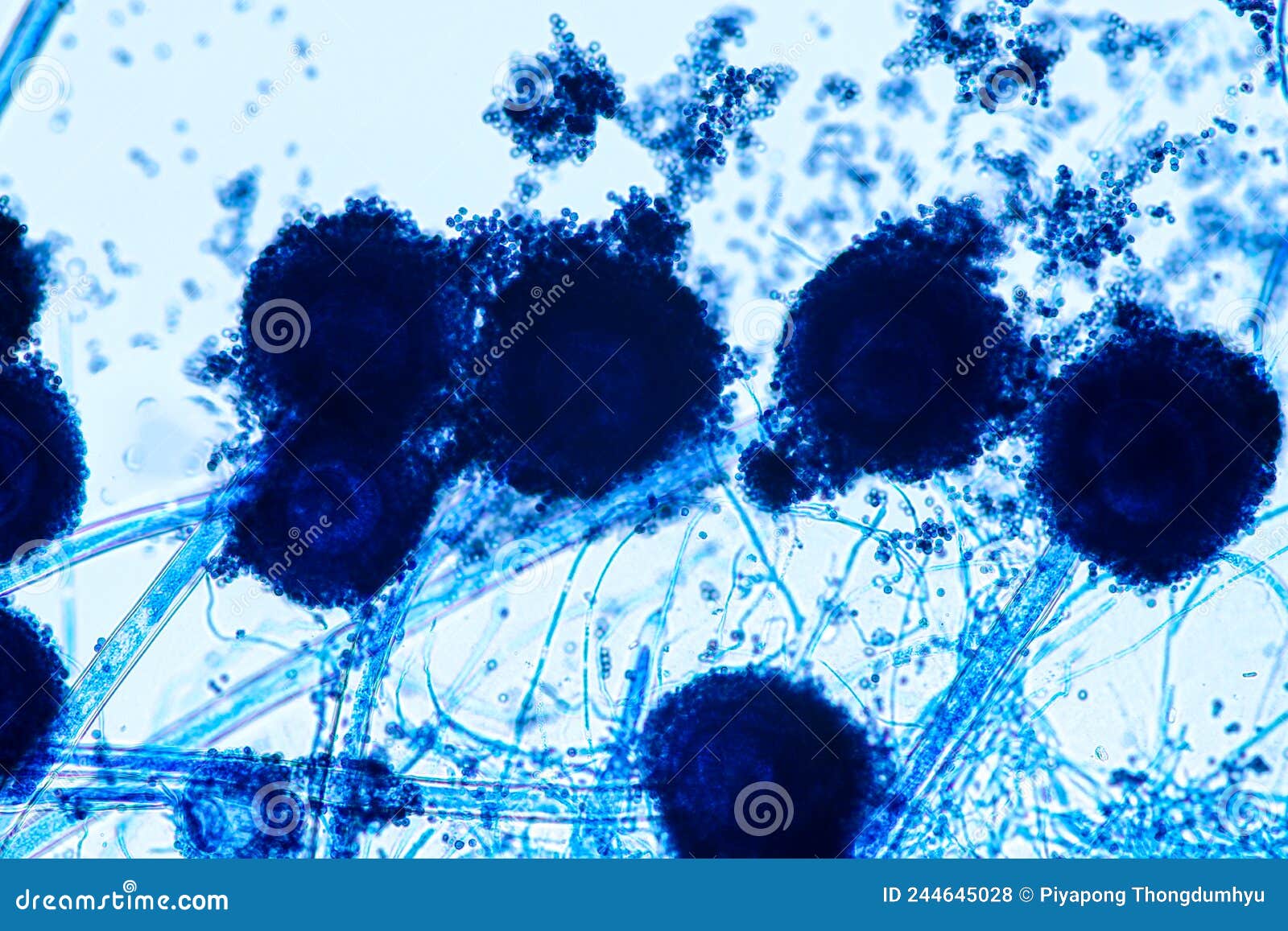 Aspergillus Niger E Aspergillus Oryzae Muffe Sotto Microscopio ...