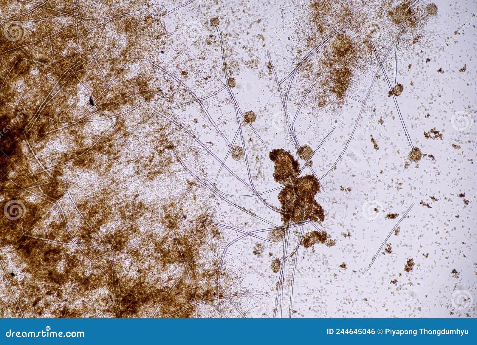 Aspergillus Niger E Aspergillus Oryzae Muffe Sotto Microscopio ...