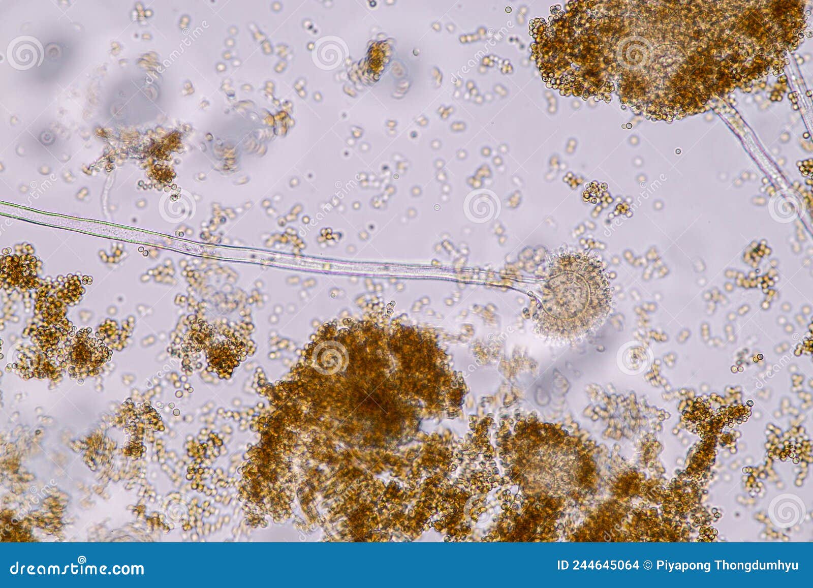 Aspergillus Niger E Aspergillus Oryzae Muffe Sotto Microscopio ...