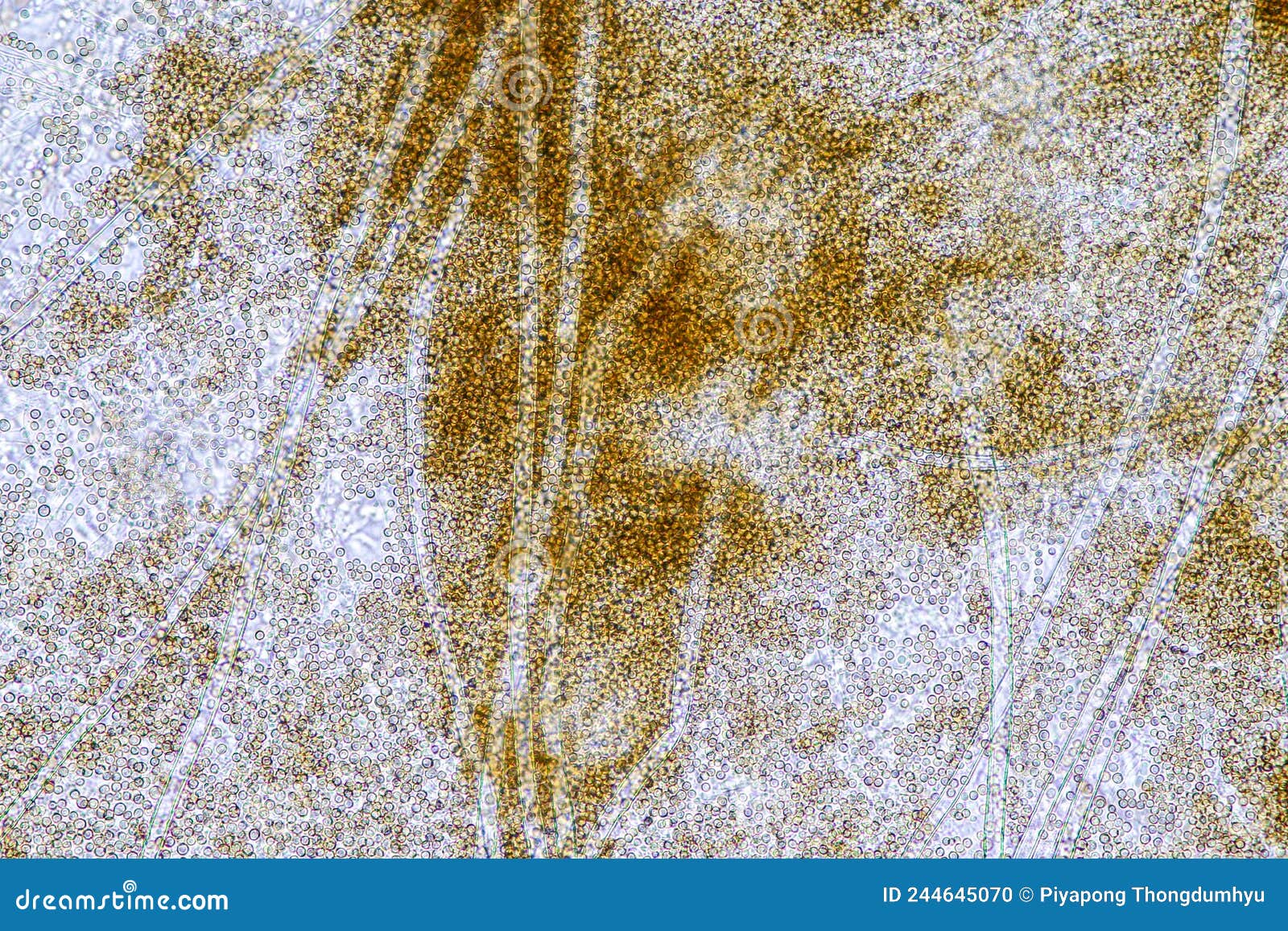 Aspergillus Niger E Aspergillus Oryzae Muffe Sotto Microscopio ...