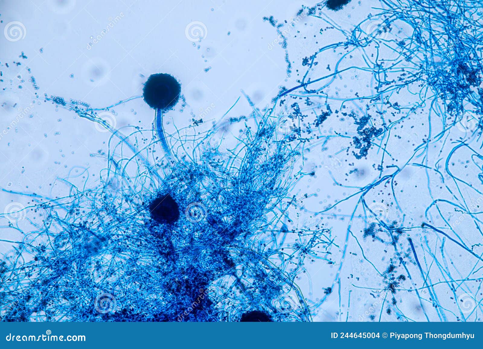 Aspergillus Niger and Aspergillus Oryzae Mold Under Microscope. Stock Photo - Image of education ...