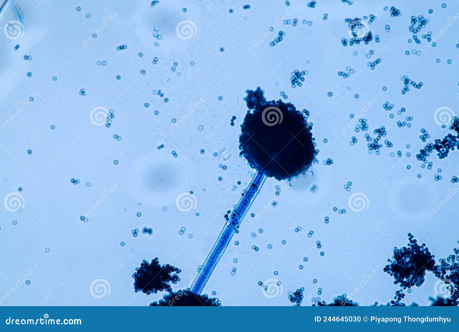 Aspergillus Niger And Aspergillus Oryzae Mold Under Microscope. Royalty ...