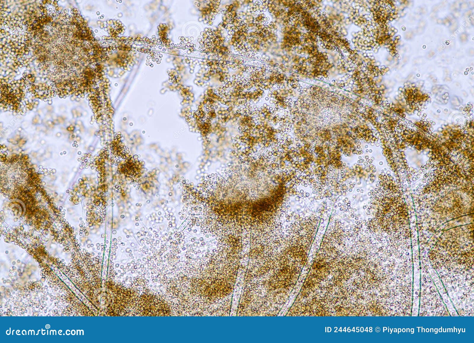 Aspergillus Niger And Aspergillus Oryzae Mold Under Microscope. Royalty ...