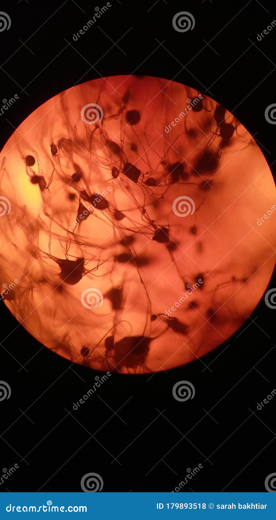 Aspergillus Niger Under Microscope Stock Photo - Image of niger ...