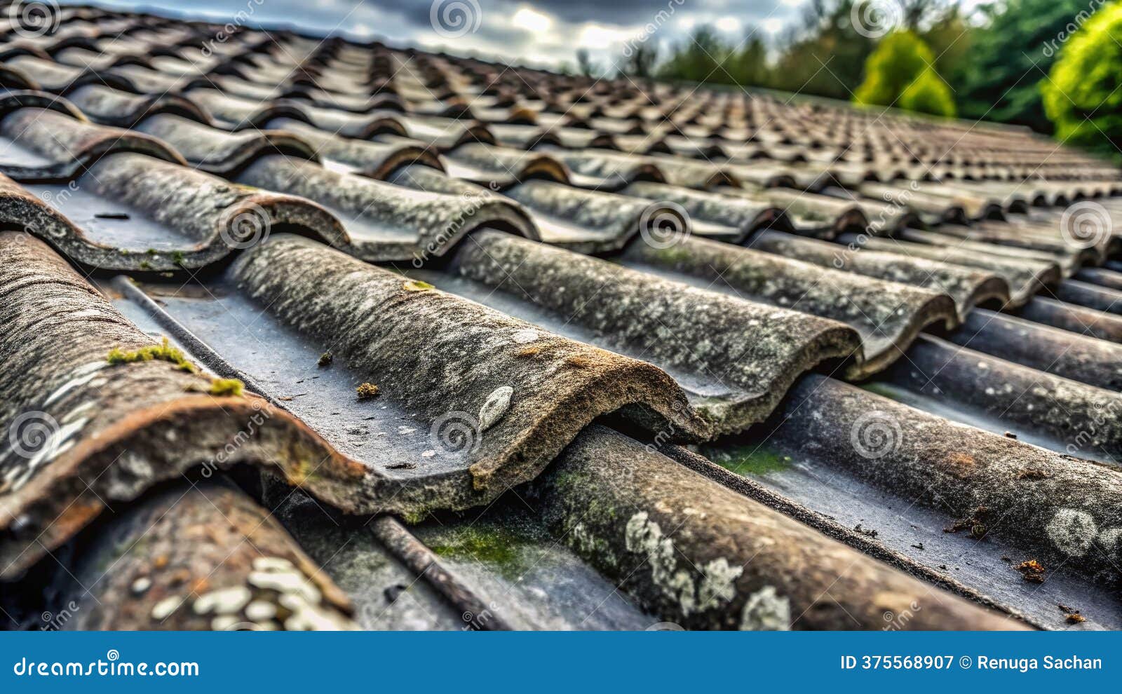 Understanding Shingles A Comprehensive Visual Guide To The Herpes ...