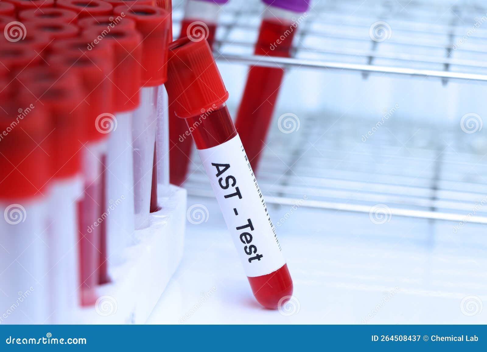 AST Test To Look for Abnormalities from Blood Stock Image - Image of ...