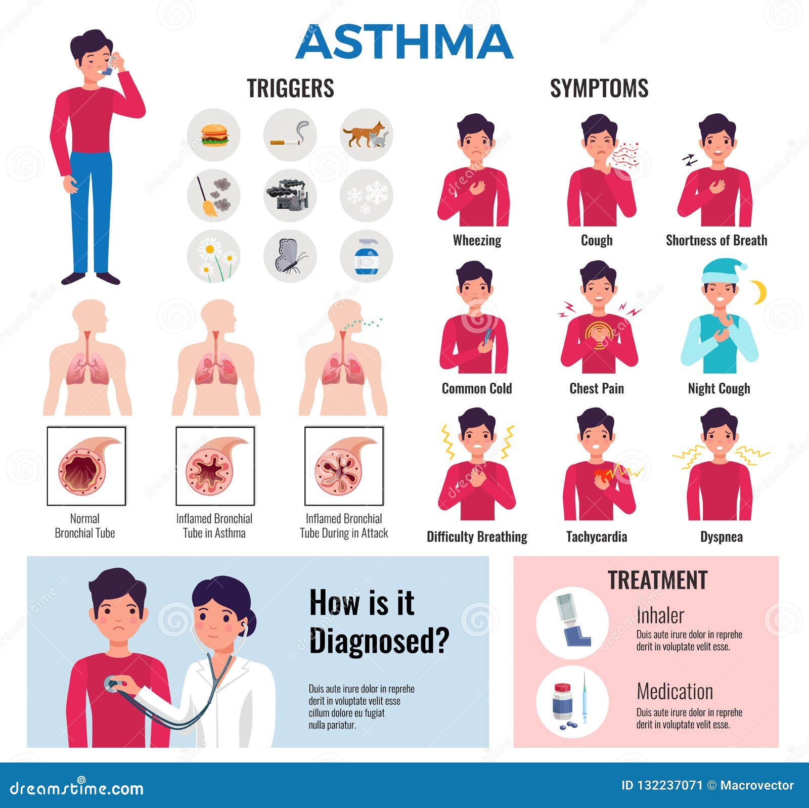 Asthma Infographic-Element-Satz Vektor Abbildung - Illustration von ...