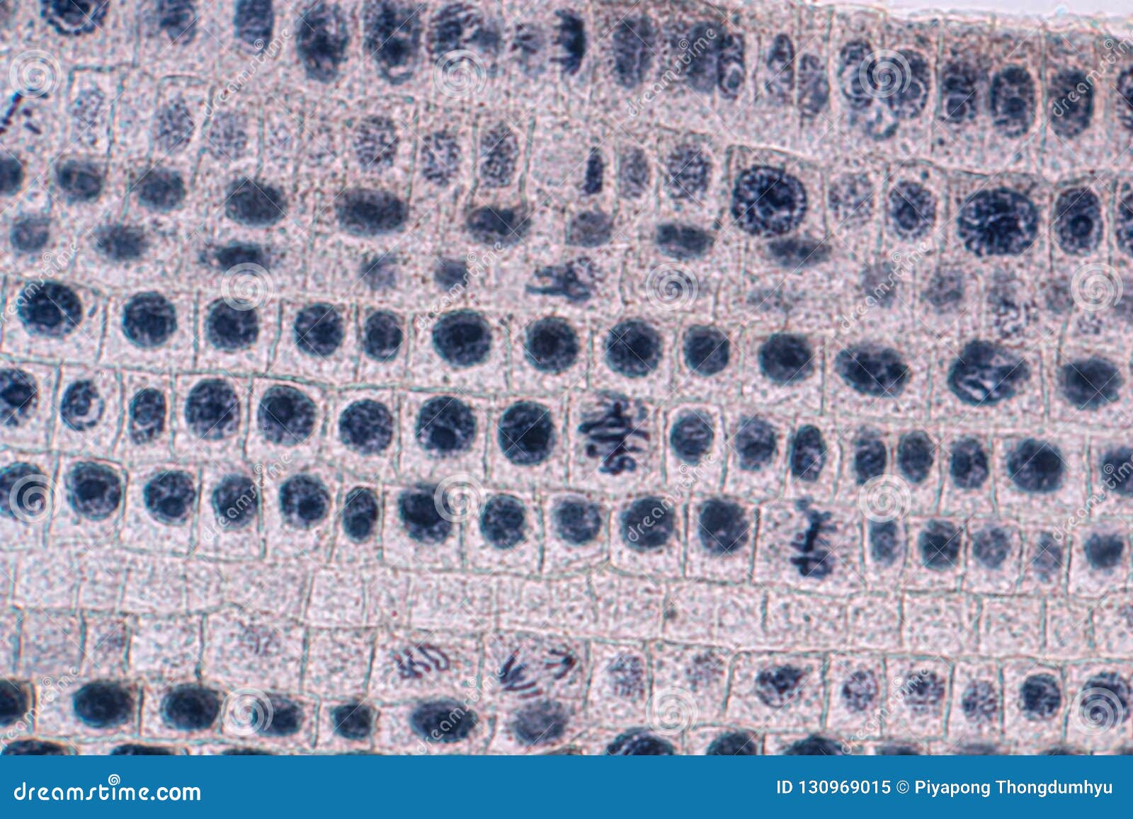 Astuce De Racine De Cellule D'oignon Et De Mitose Dans L'astuce De ...