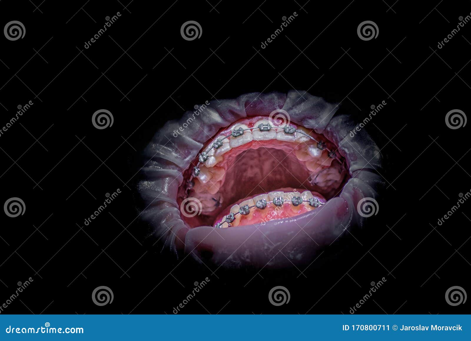 Asustada boca abierta imagen de archivo. Imagen de ciencia - 170800711