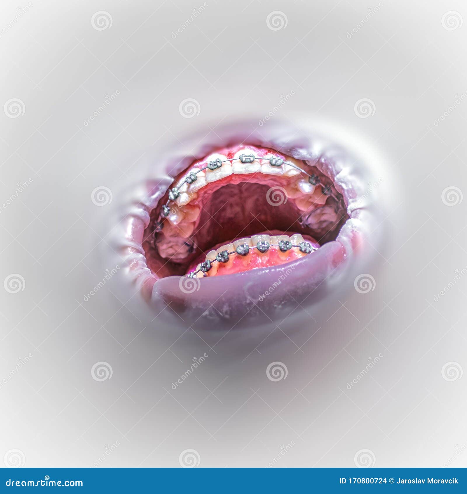 Asustada boca abierta foto de archivo. Imagen de espeluznante - 170800724