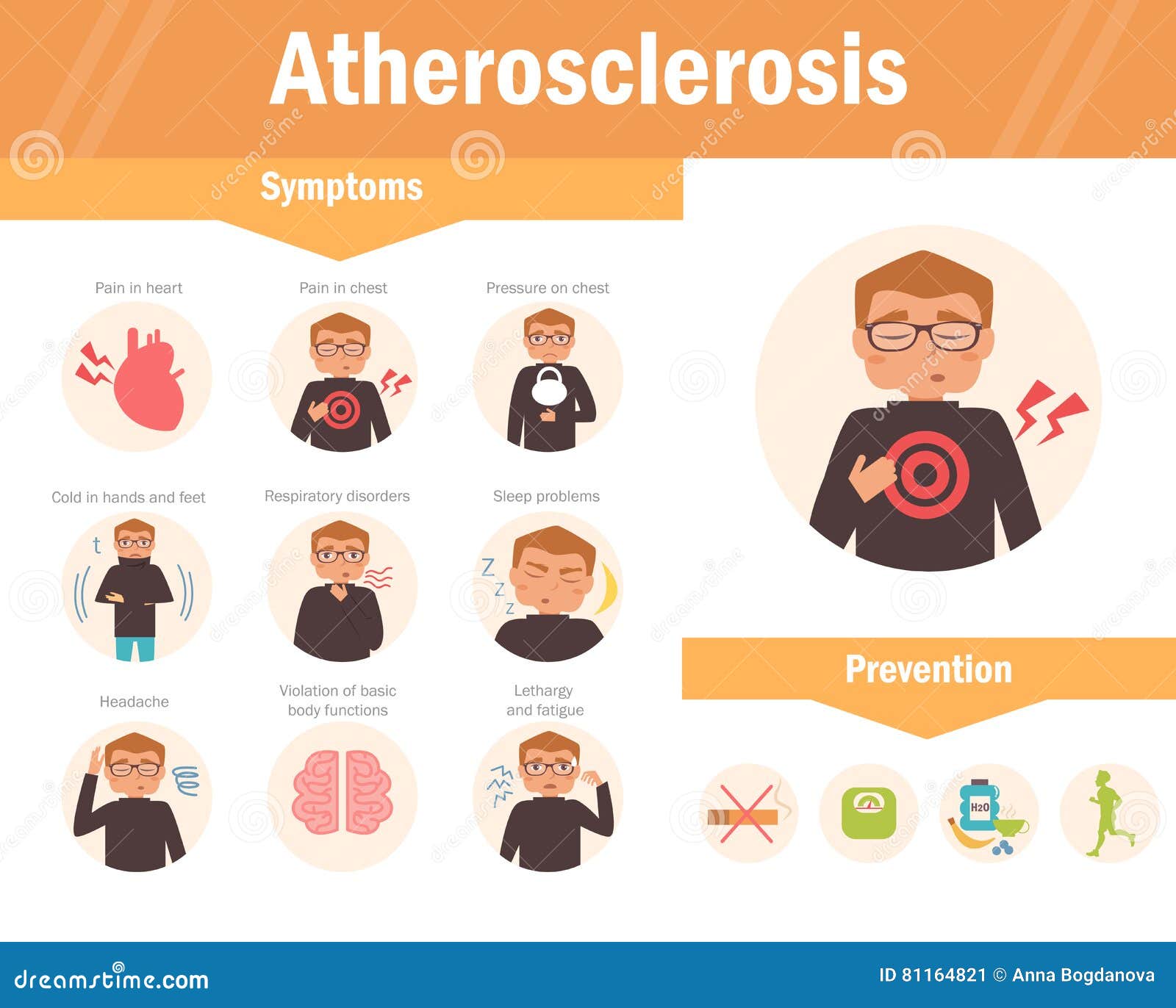 Atherosclerose Symptomen Vector Vector Illustratie - Illustration of ...