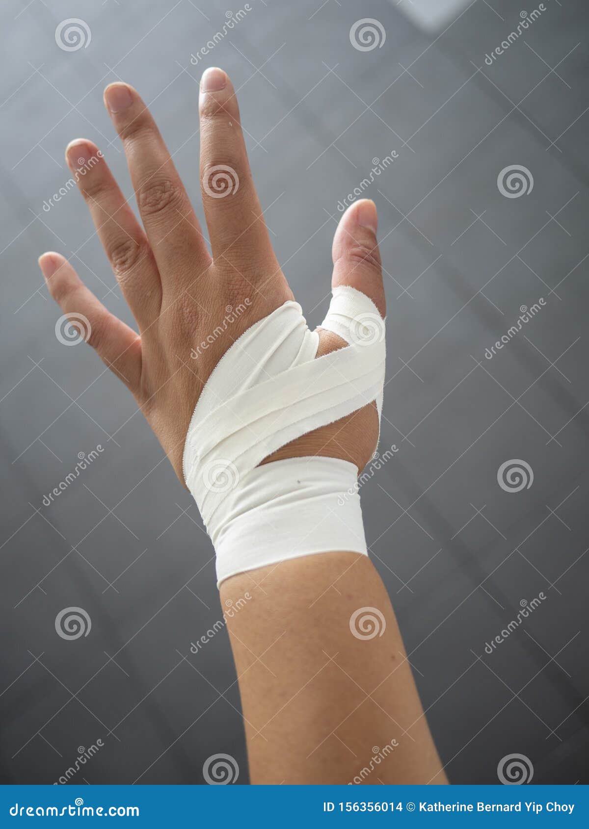 Athlete with a taped thumb stock photo. Image of physiotherapy - 156356014