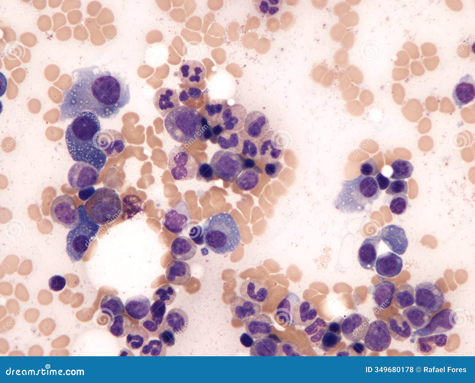 Plasma Cell TS Royalty-Free Stock Photo | CartoonDealer.com #84219981